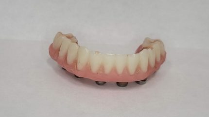 We Provide All-On-4 Dental Implants | Monfredi Family Dental