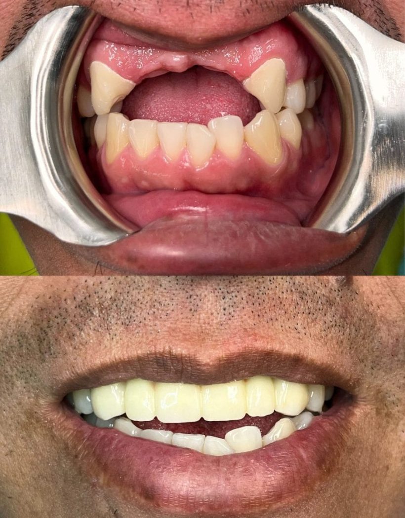 Smile Gallery | Monfredi Family Dental