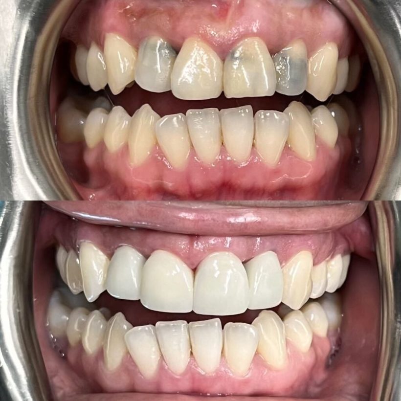 Smile Gallery | Monfredi Family Dental