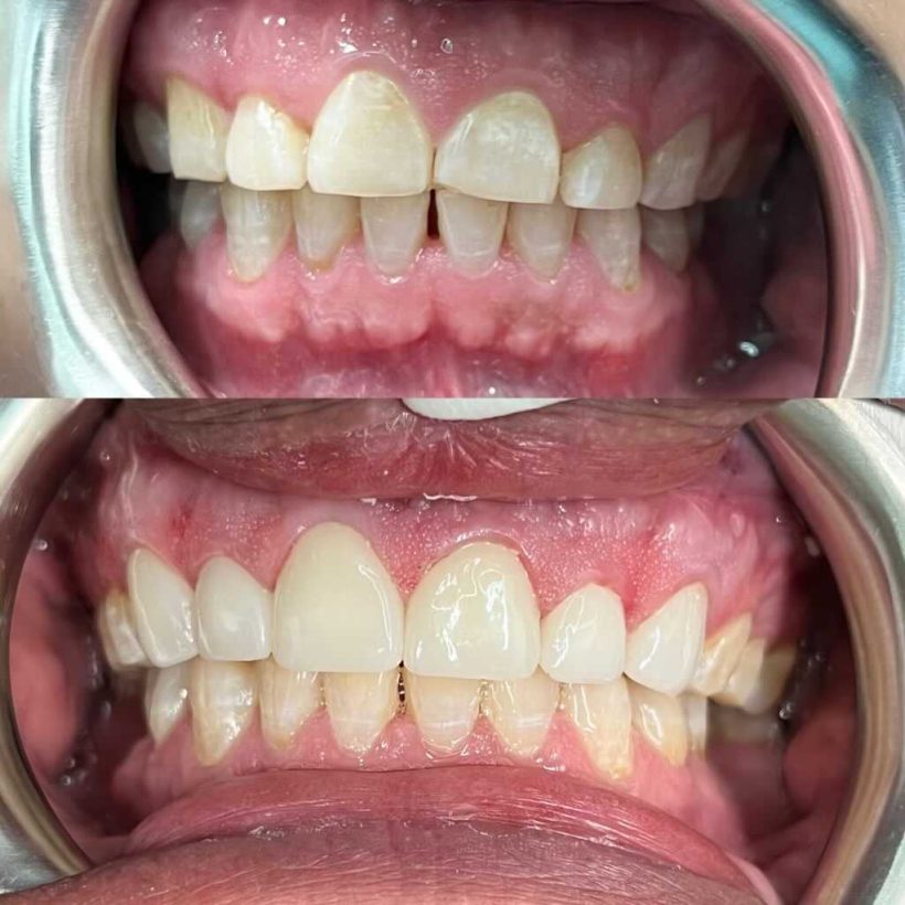 Smile Gallery | Monfredi Family Dental